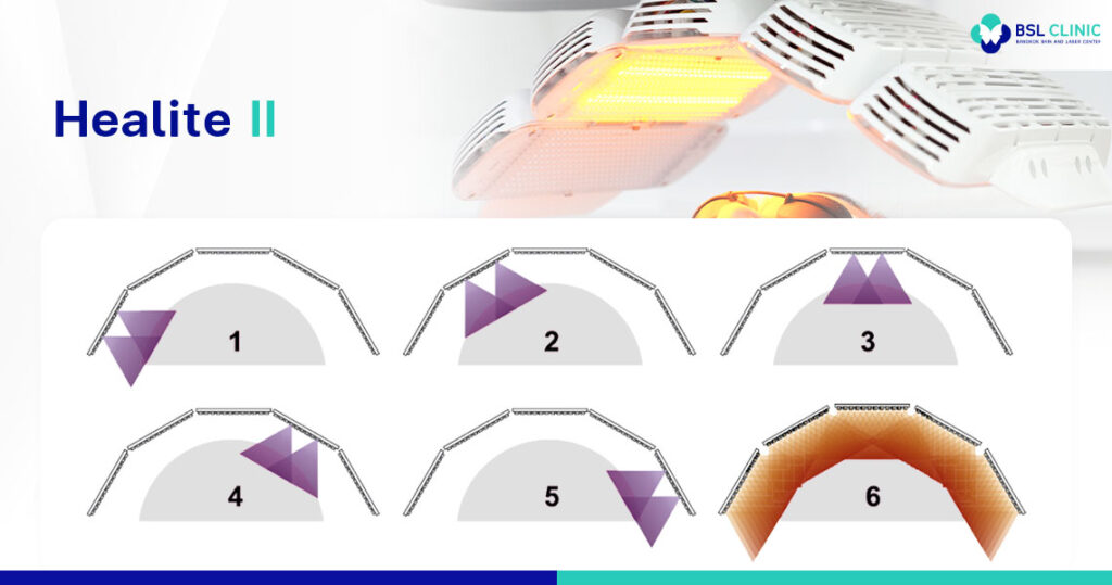Photodynamic Therapy: A Gentle & Effective Approach to Skin